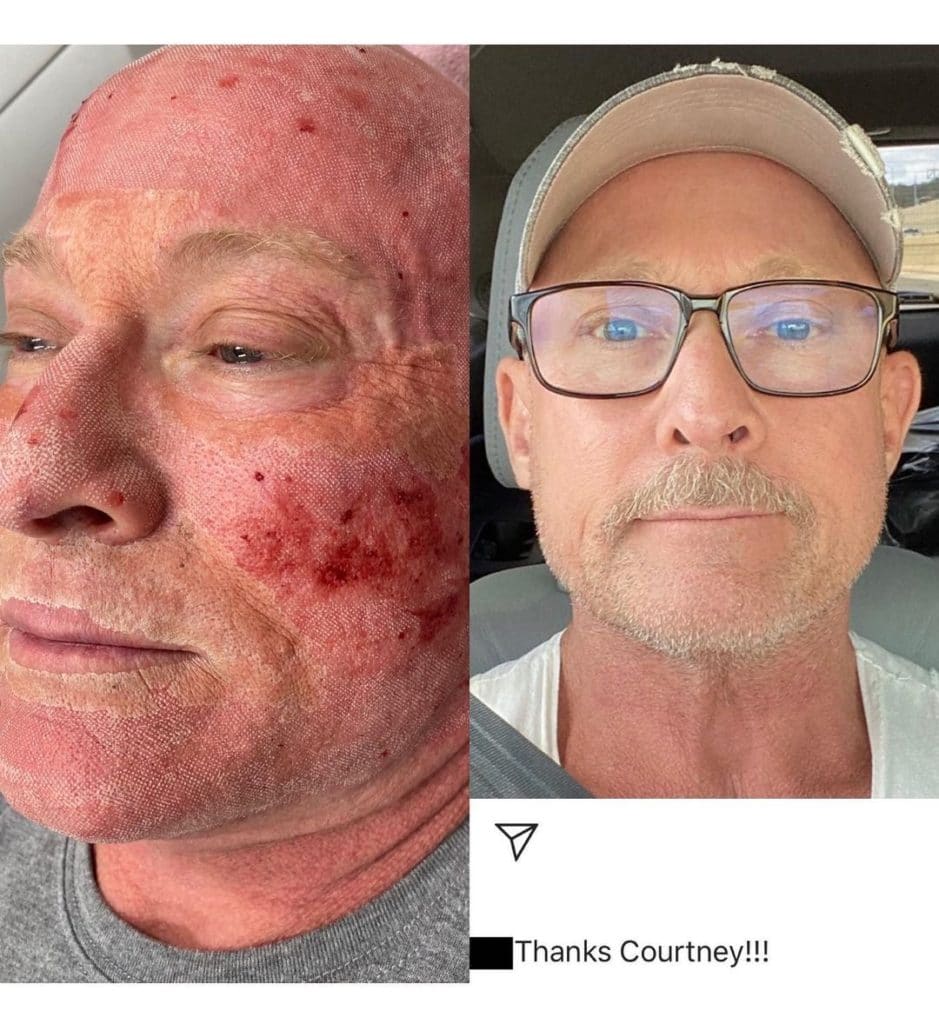 Courtney Grant Before & Afters - Jennifer L. Walden, MD, PLLC